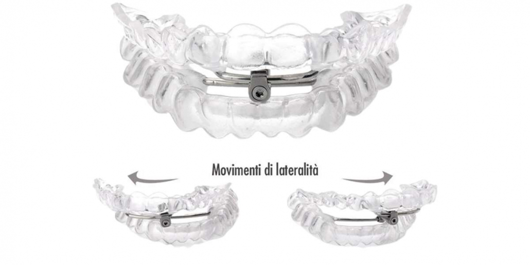 MAD, apnee notturne e russamento - Dr.ssa Cristina Vitale