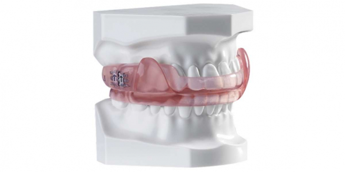 MAD, apnee notturne e russamento - Dr.ssa Cristina Vitale